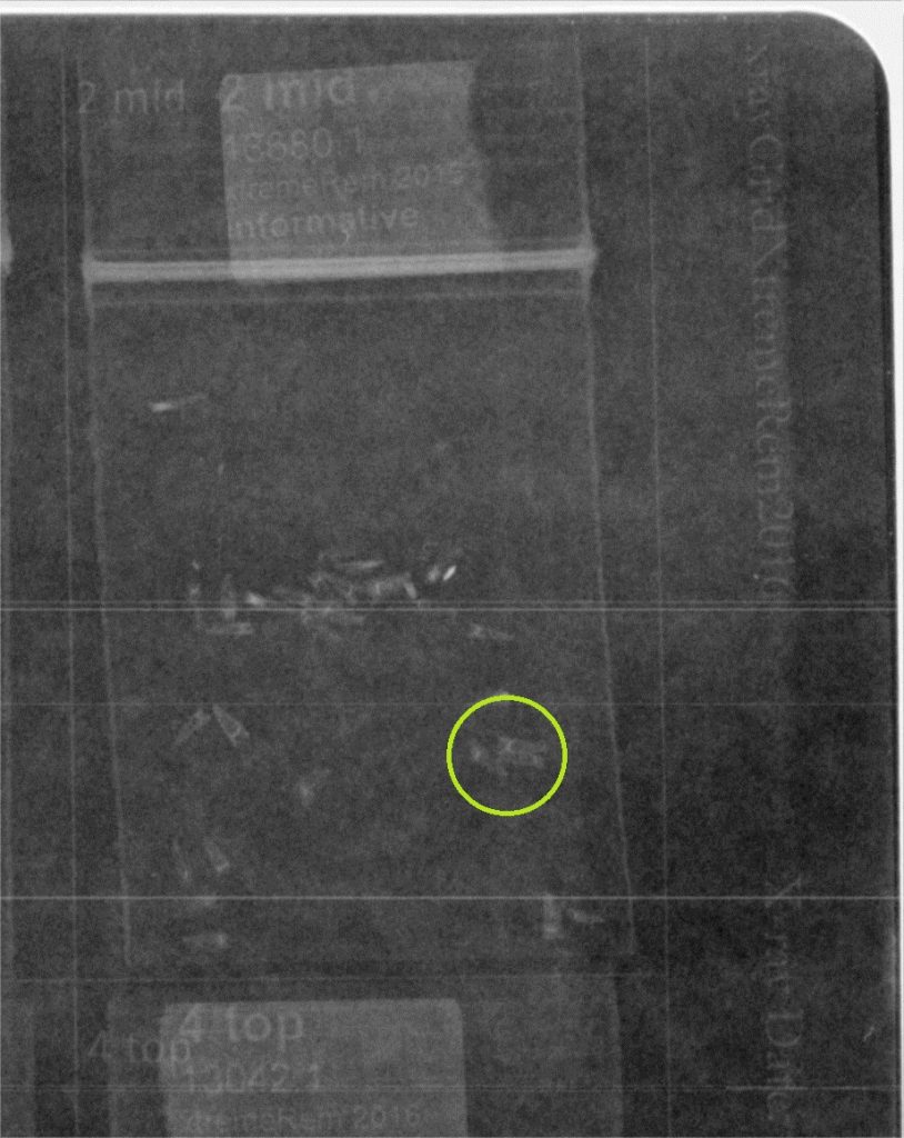 Perfecting the X-ray image: EBImage package in R « The Echinacea Project